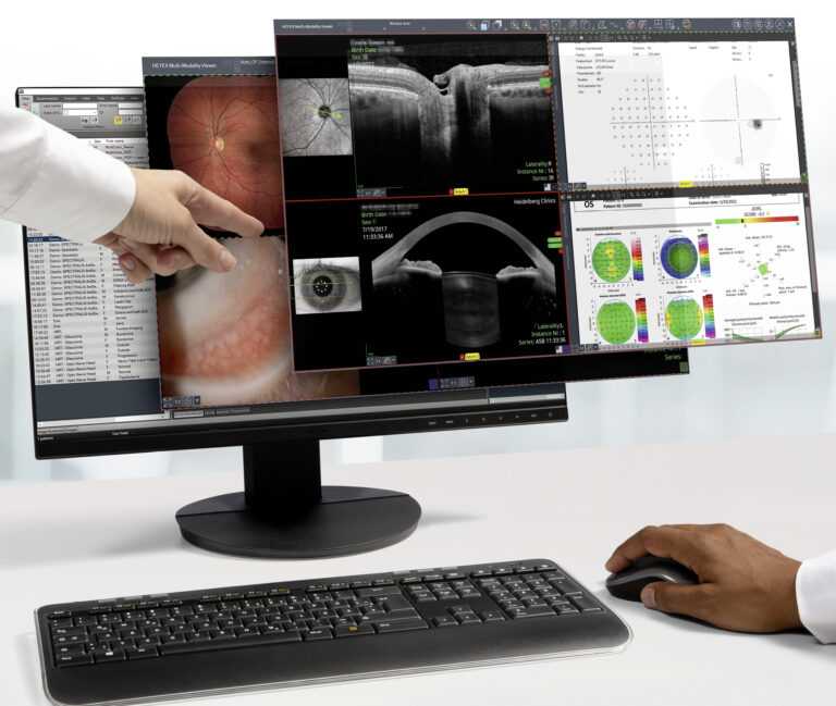 HEYEX 2 from Heidelberg Engineering - Hospital Services Limited
